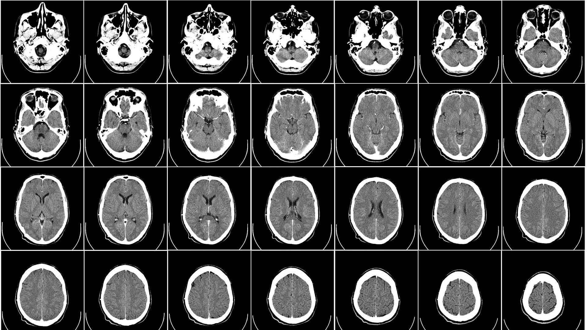 How You Can View DICOM Medical Images From A CD